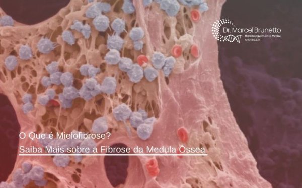 O Que é Mielofibrose? Saiba Mais sobre a Fibrose da Medula Óssea - Dr ...
